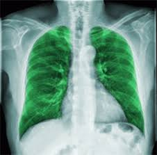 New method to produce 3D images of lungs developed - Daily Excelsior