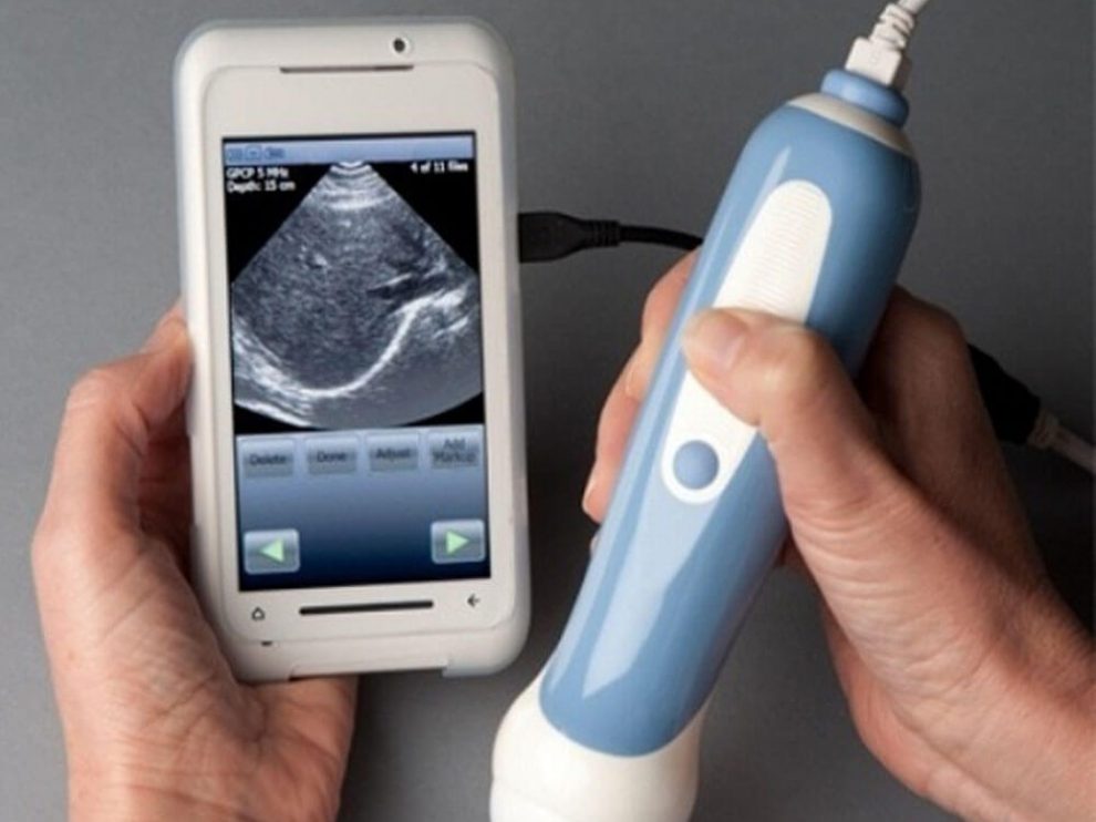 Portable ultrasound machine can be powered by smartphone - Daily Excelsior