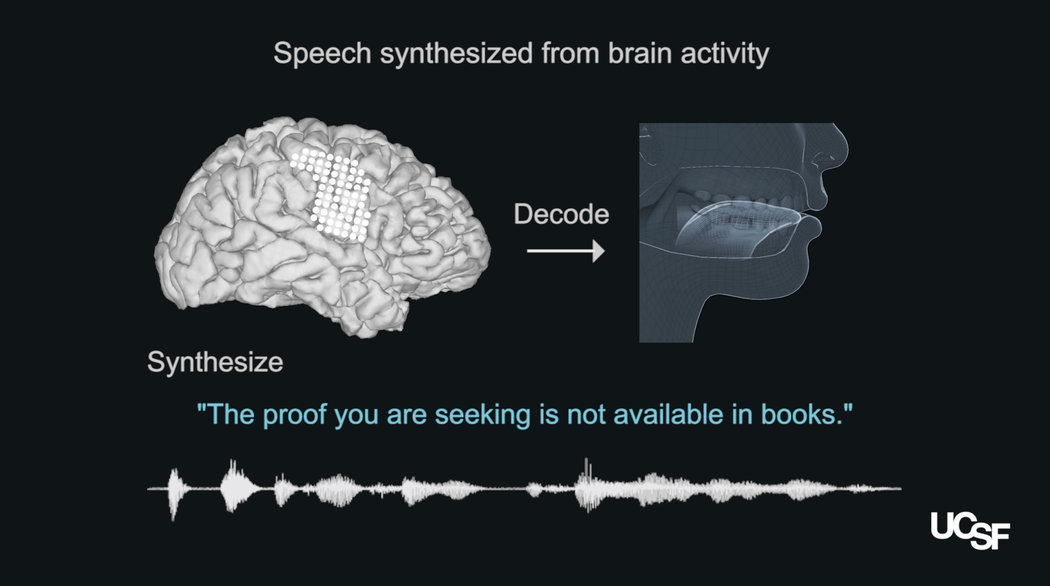 Virtual vocal tract can generate speech from brain signals - Daily ...