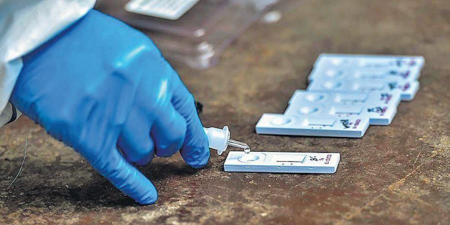 Kriya Medical Technologies gets DCGI nod for RT-PCR kit - Daily Excelsior
