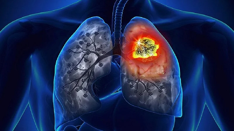 Over 32,000 Cancer Cases Reported In Recent Years In Jammu And Kashmir ...
